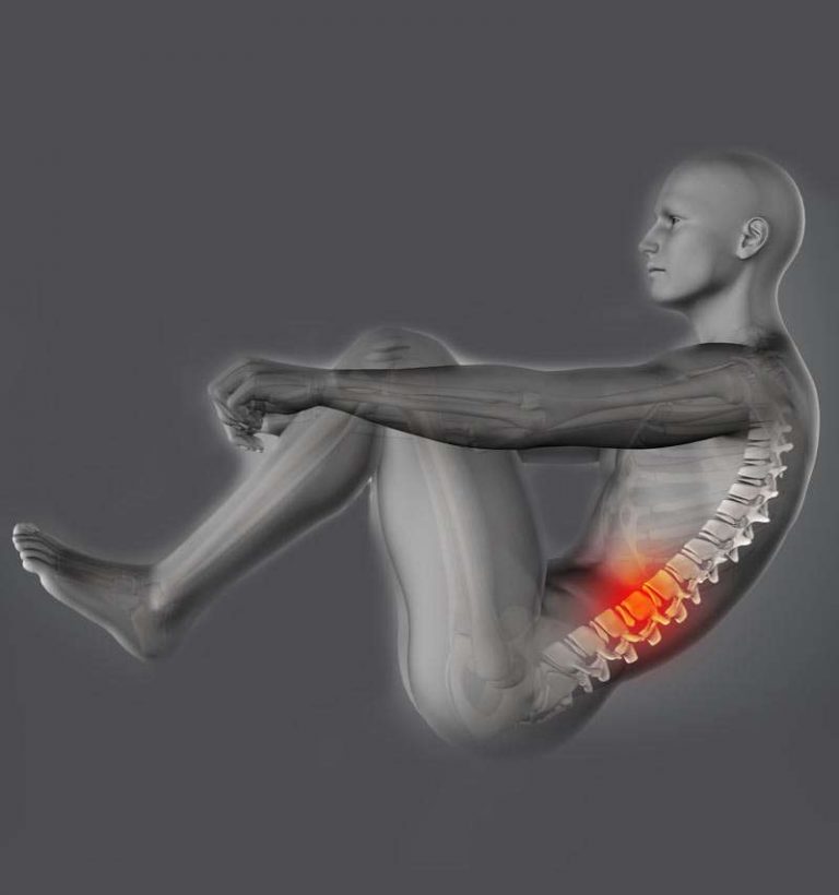 Non Surgical Spinal Decompression Therapy | Dunn Chiropractic Center ...